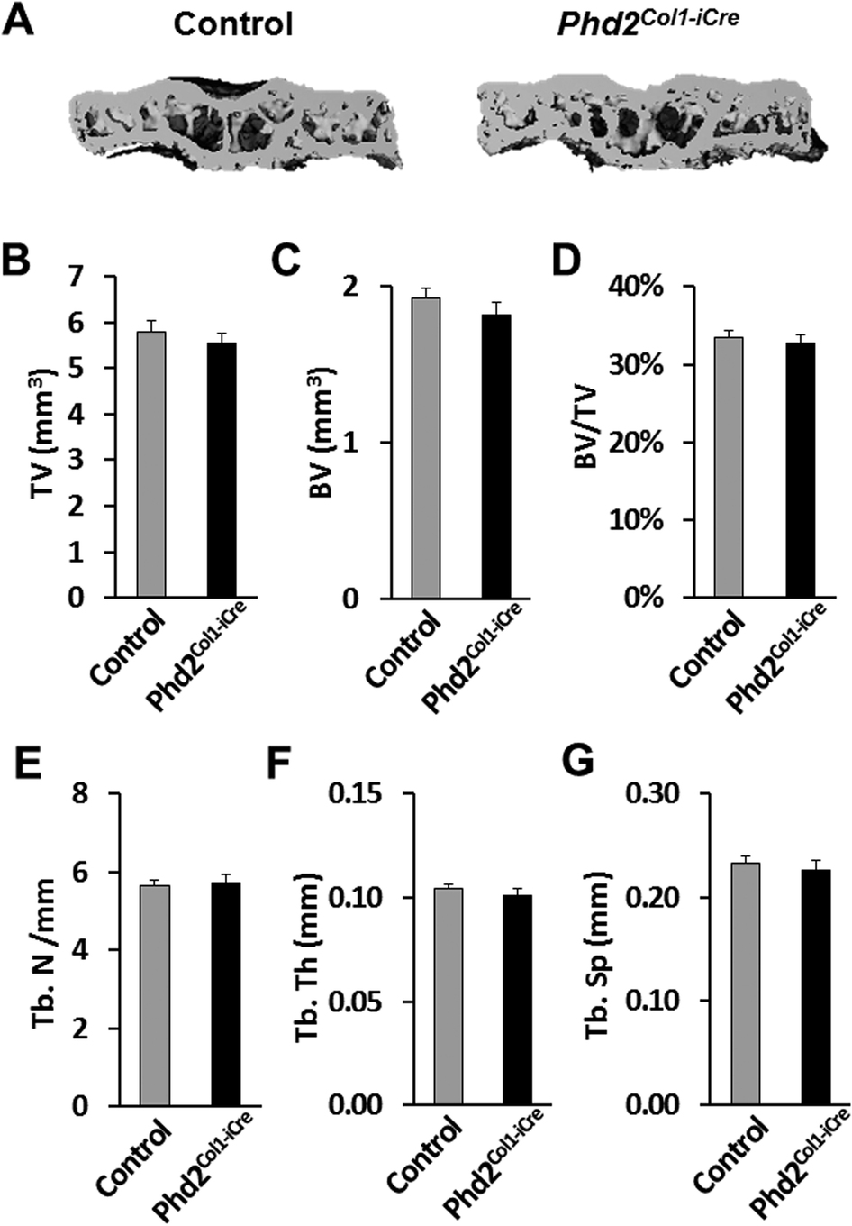 Prolyl Hydroxylase Domain-Containing Protein 2 (Phd2) Regulates ...