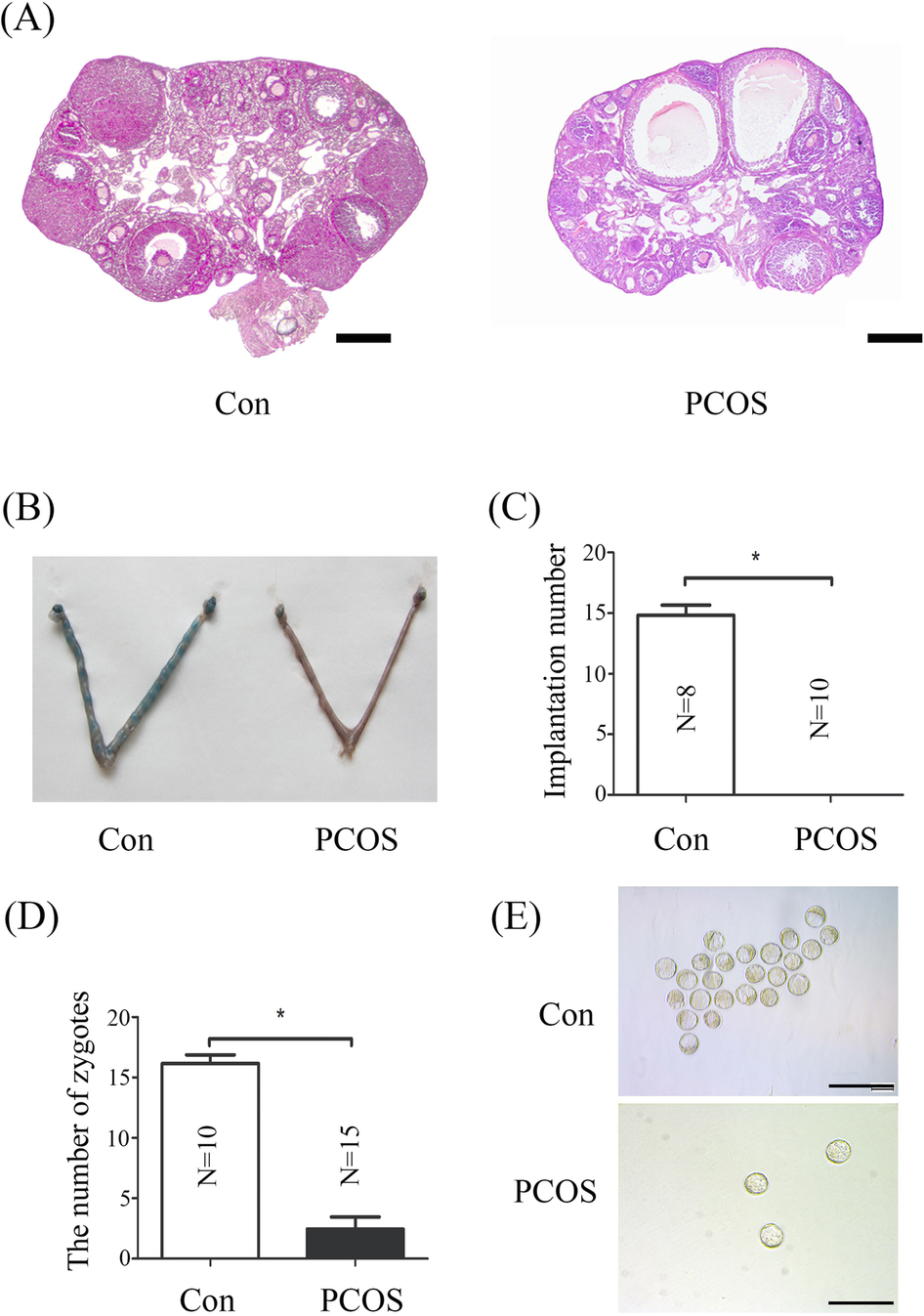Impaired receptivity and decidualization in DHEA-induced PCOS mice ...