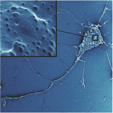 Helium Ion Microscopy Visualizes Lipid Nanodomains in Mammalian Cells ...