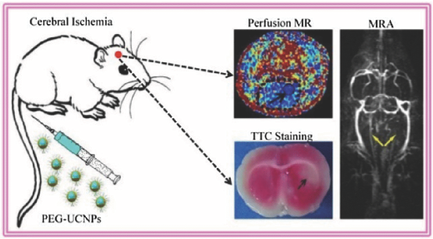 High‐Performance Upconversion Nanoprobes for Multimodal MR Imaging of ...