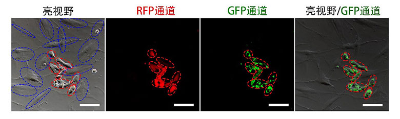 新型碳基二维材料C3N又立新功：肿瘤的高效靶向智能治疗- X-MOL资讯