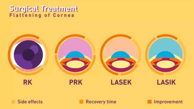 《自然》子刊：无需手术，永久治好近视！全球首个无创近视治疗术诞生- X-MOL资讯